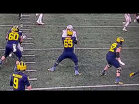 Zak zinter leg injury